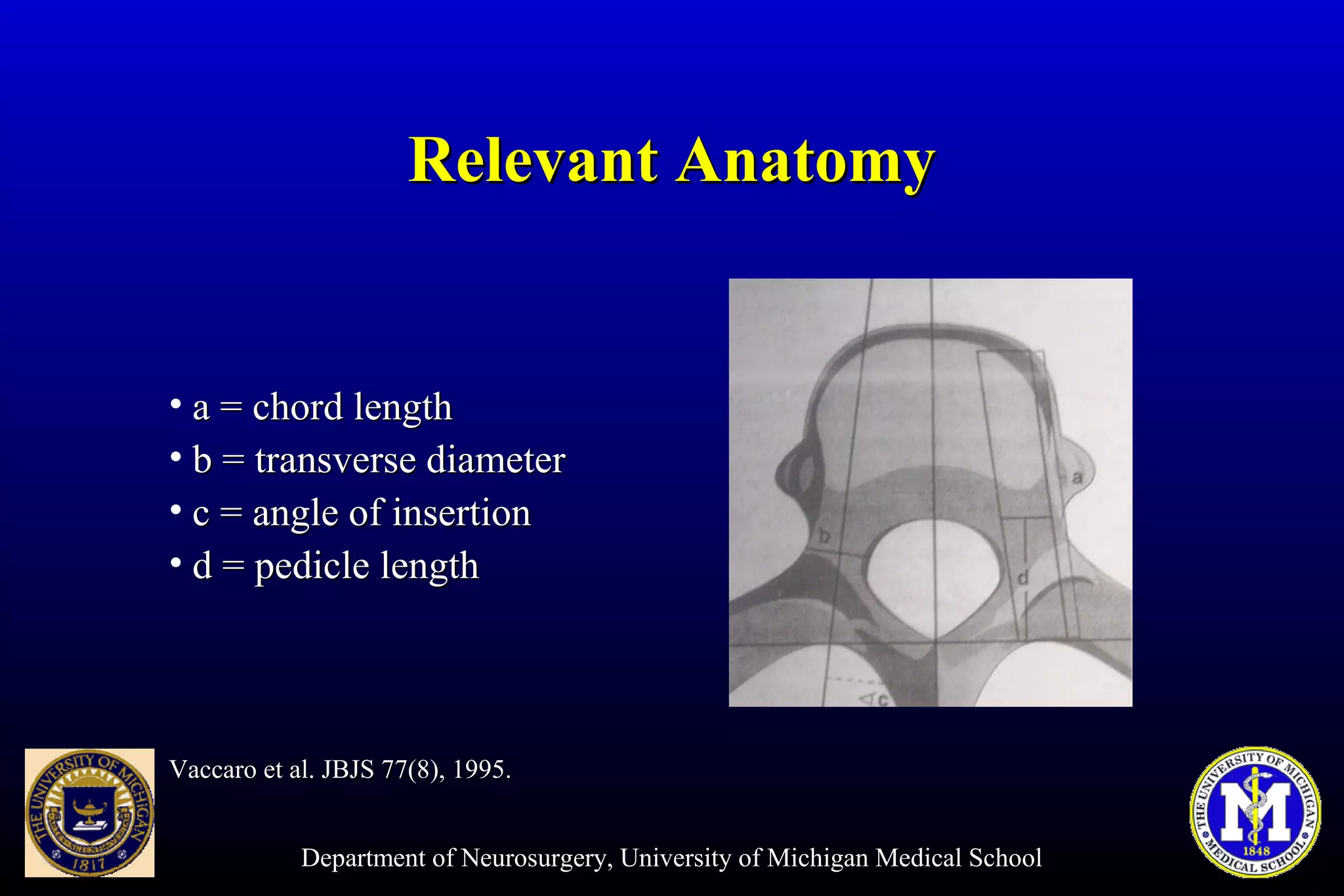 Thoracic pedicle screws | PPT