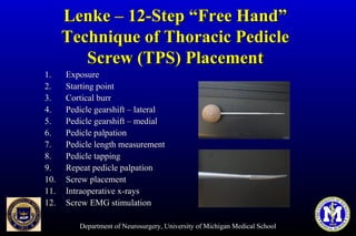 Thoracic pedicle screws | PPT