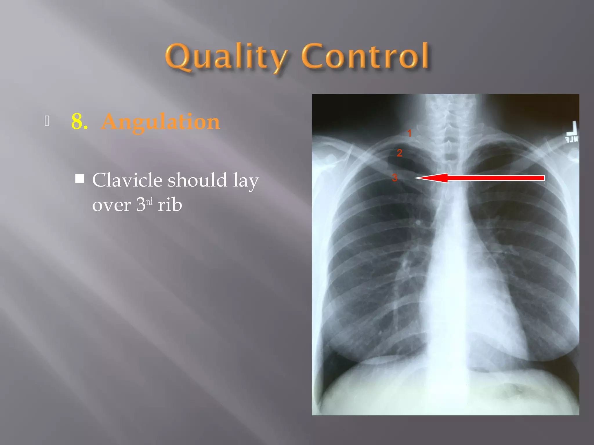 Thoracic positioning | PPT