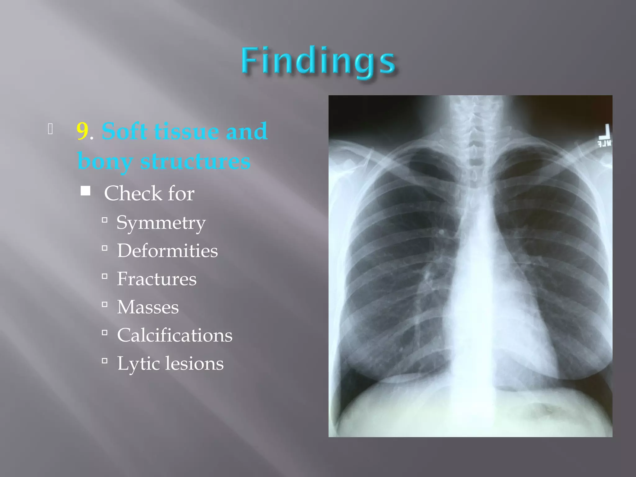 Thoracic positioning | PPT