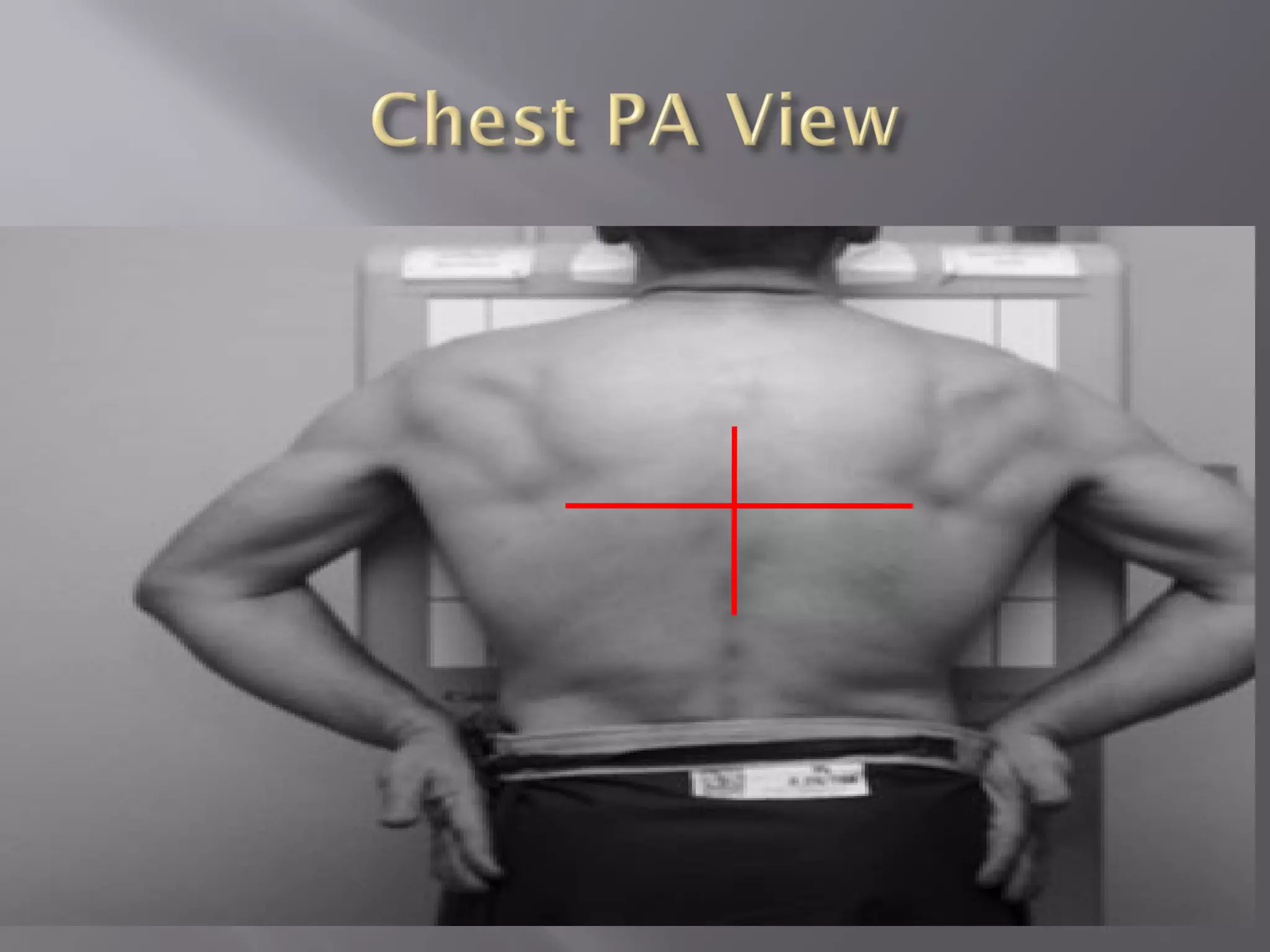 Thoracic positioning | PPT