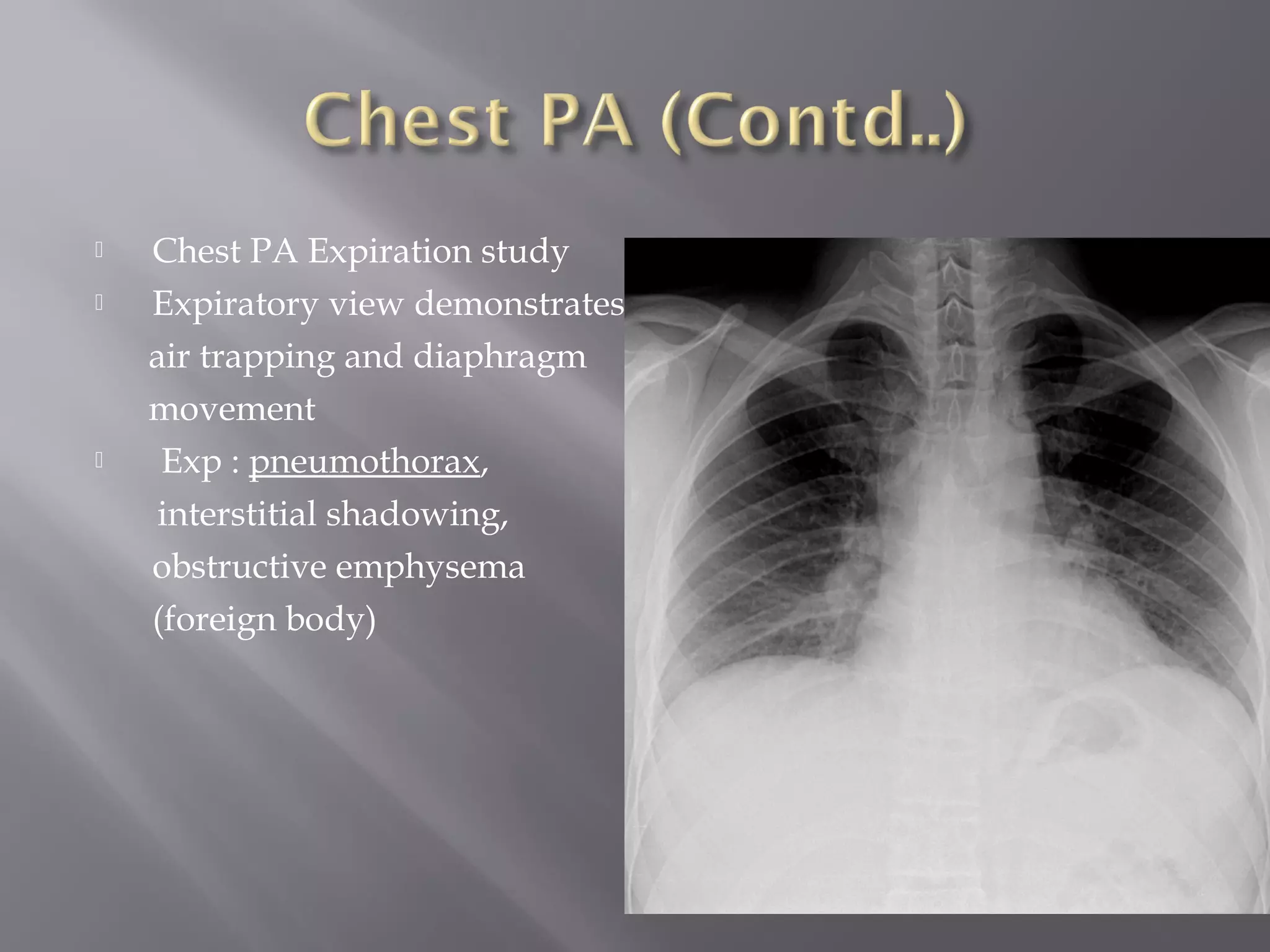Thoracic positioning | PPT