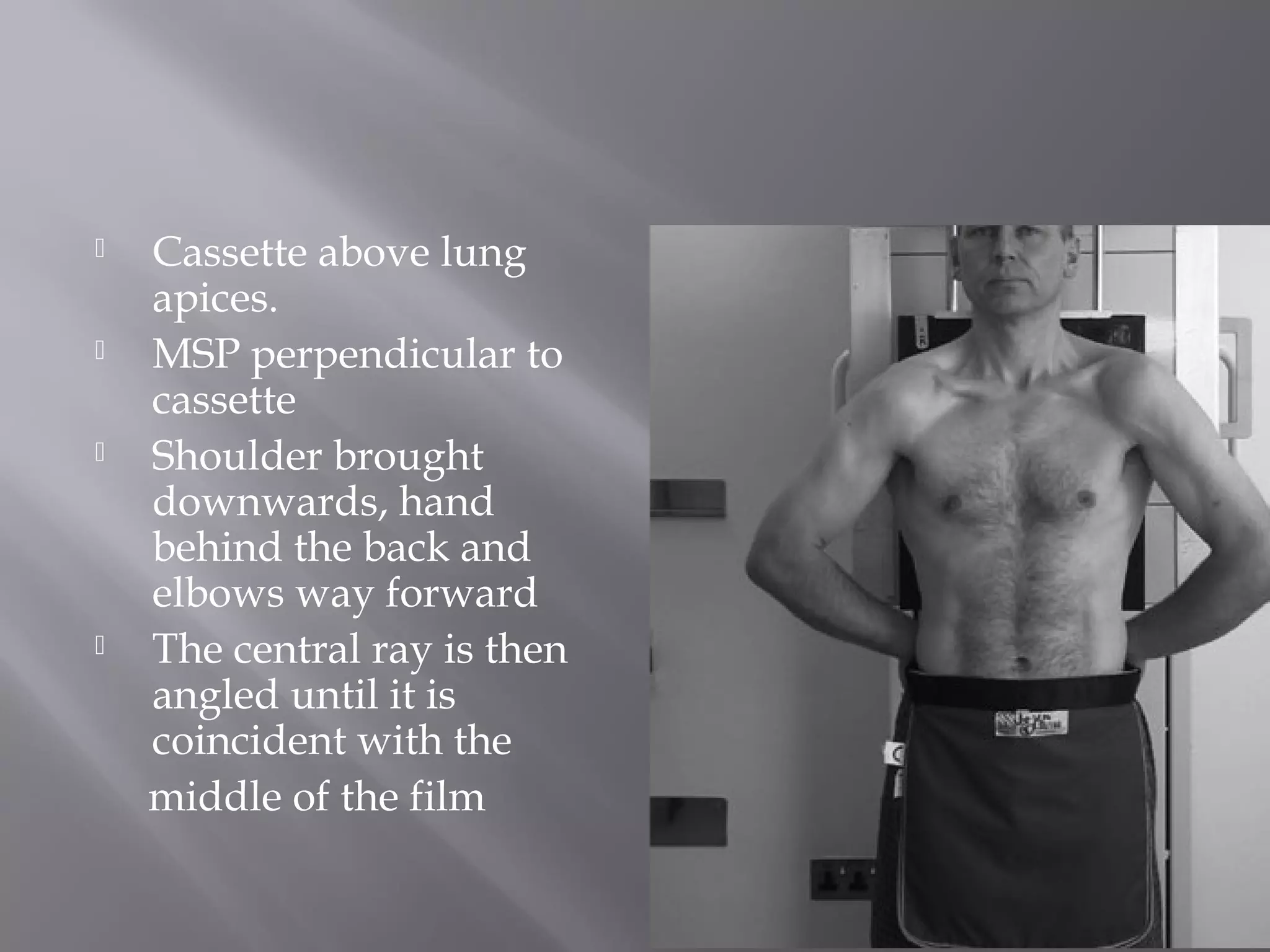 Thoracic positioning | PPT
