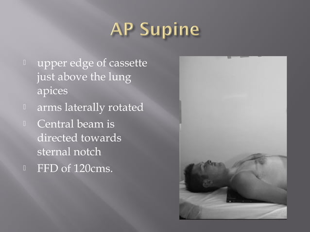 Thoracic positioning | PPT | Lung and Respiratory Health | Diseases and ...