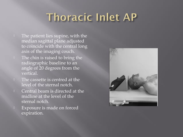 Thoracic positioning | PPT | Lung and Respiratory Health | Diseases and ...