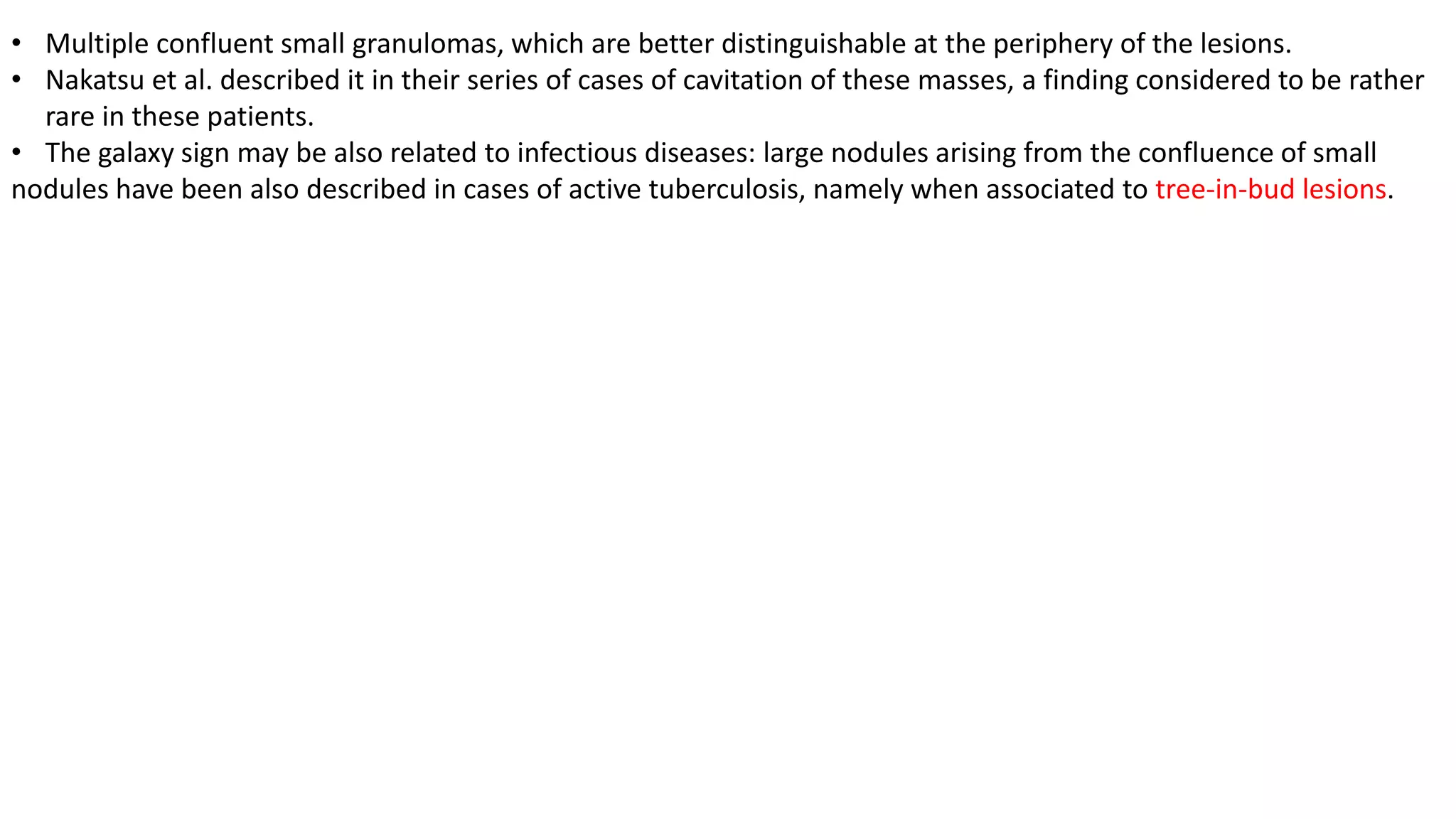 Thoracic radiological signs | PPTX