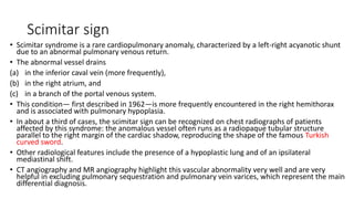 Thoracic radiological signs | PPTX