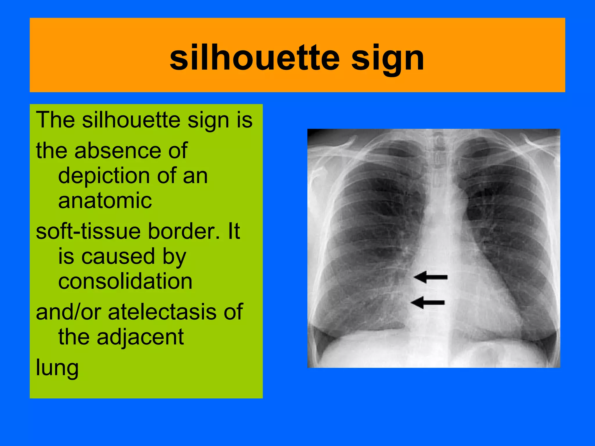 Thoracic imaging terminology | PPT