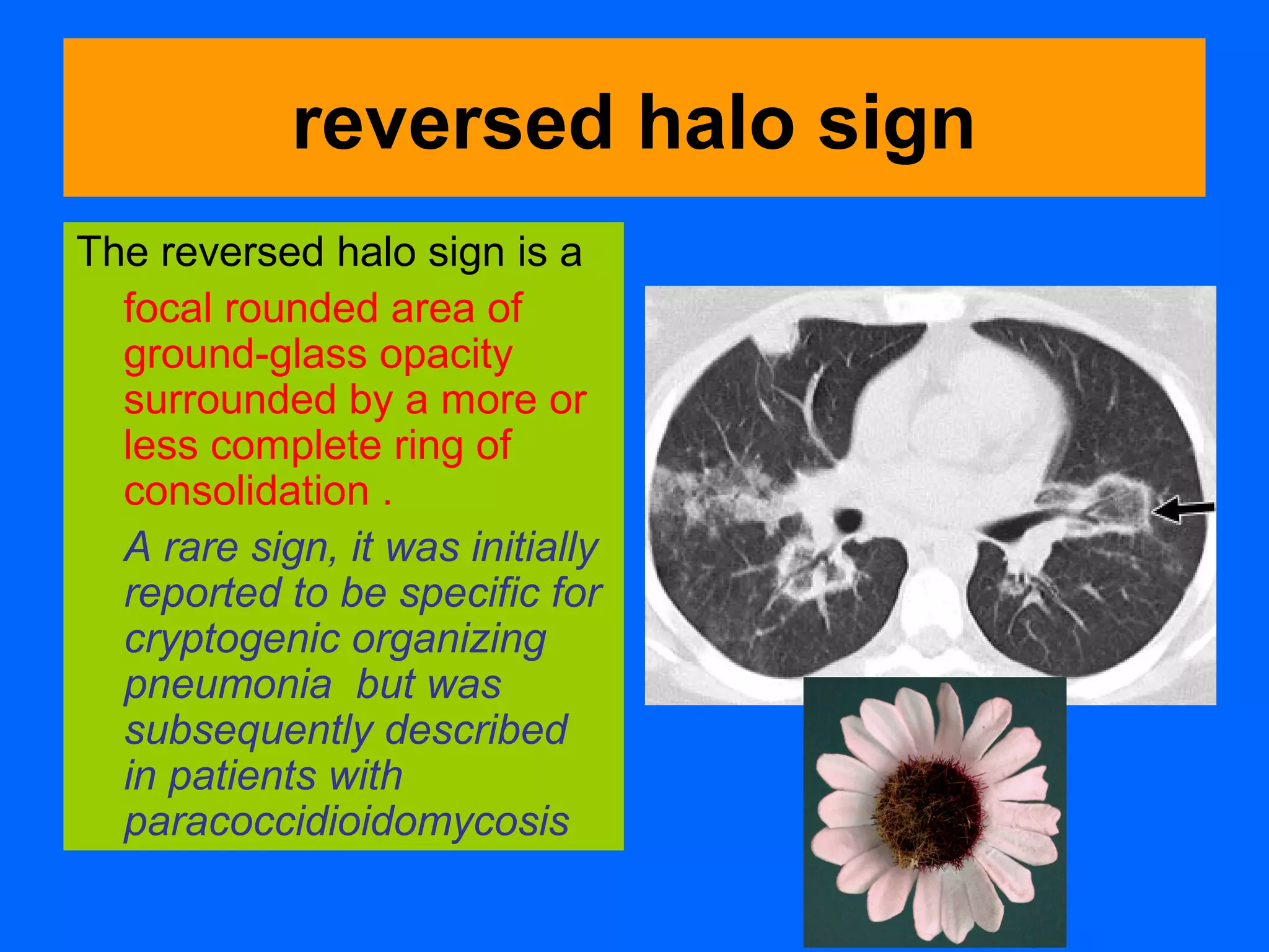 Thoracic imaging terminology | PPT