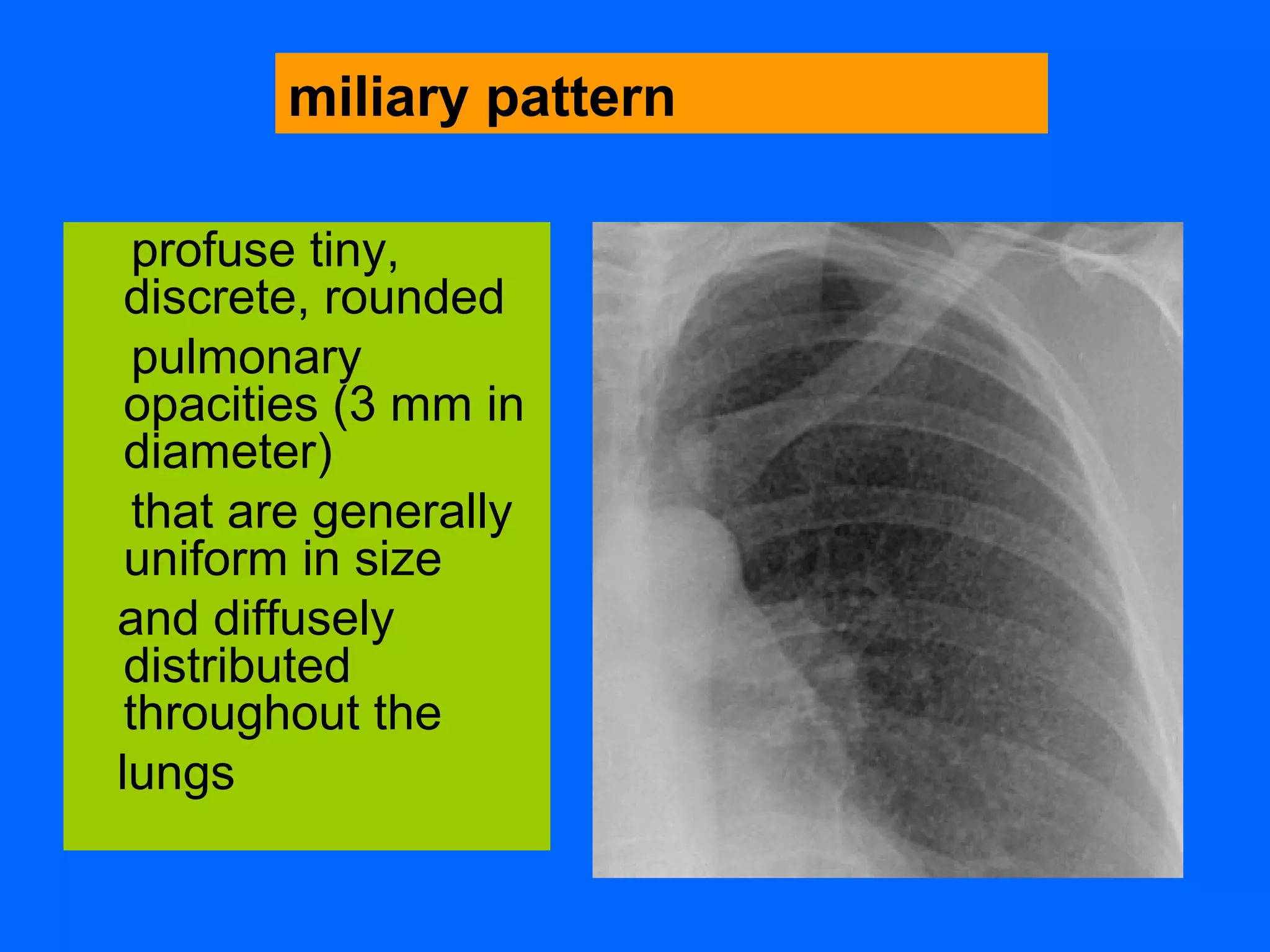Thoracic imaging terminology | PPT