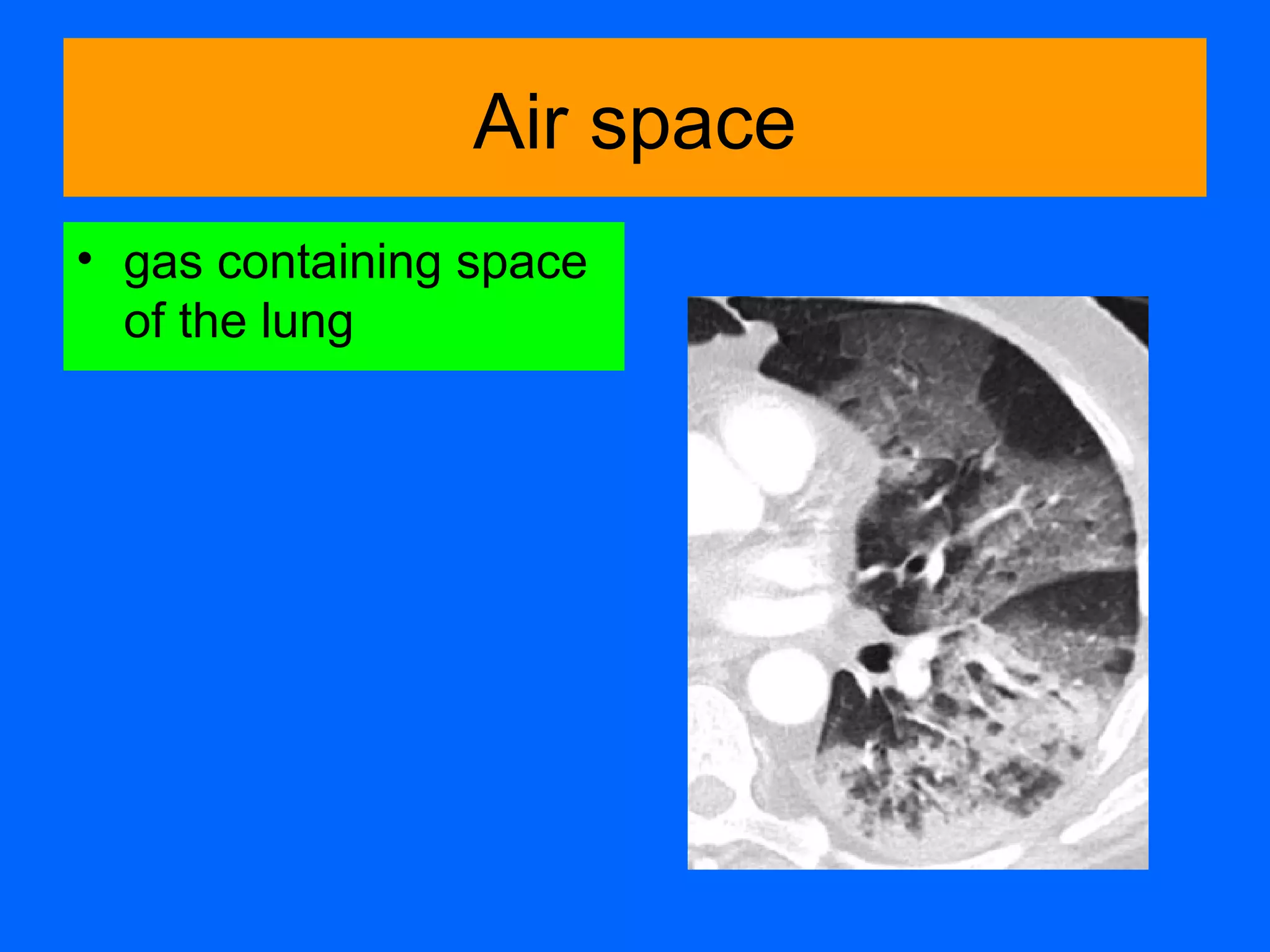 Thoracic imaging terminology | PPT | Lung and Respiratory Health ...