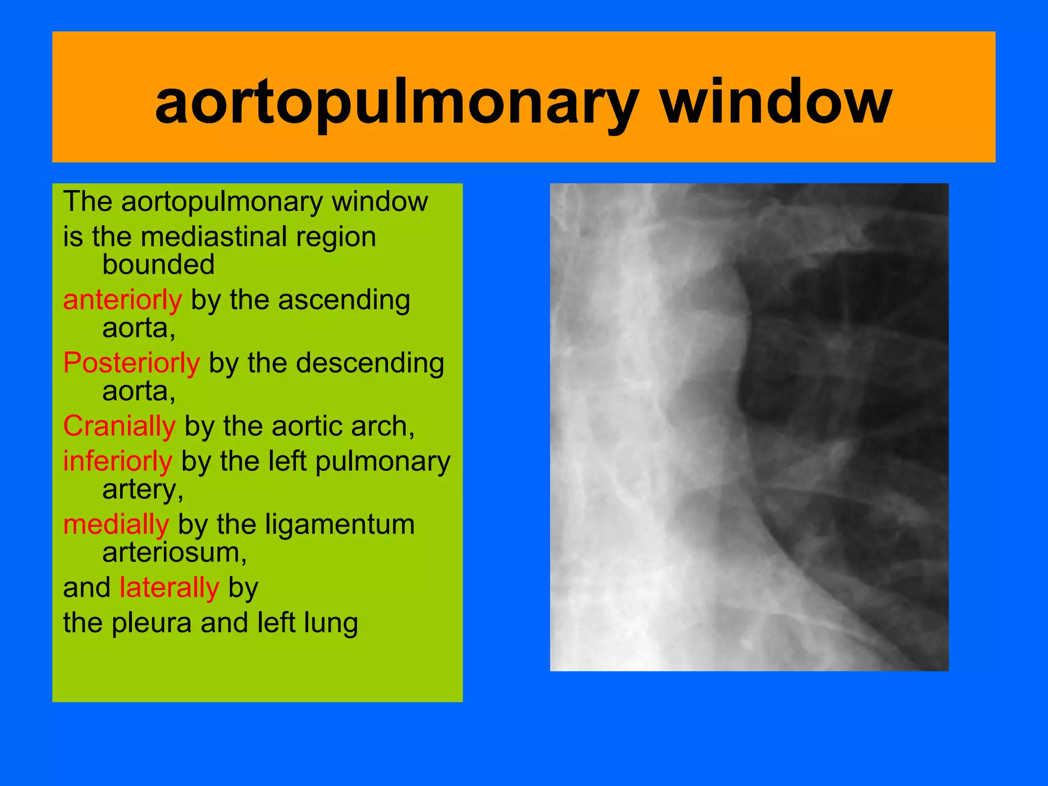 Thoracic imaging terminology | PPT