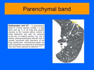 Thoracic imaging terminology | PPT