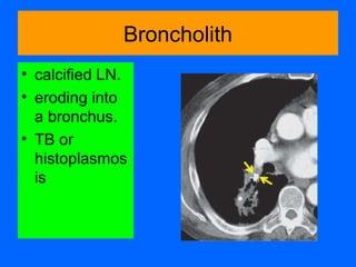 Thoracic imaging terminology | PPT