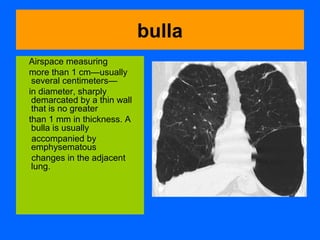 Thoracic imaging terminology | PPT