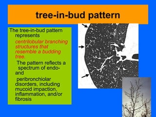 Thoracic imaging terminology | PPT