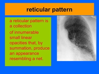 Thoracic imaging terminology | PPT