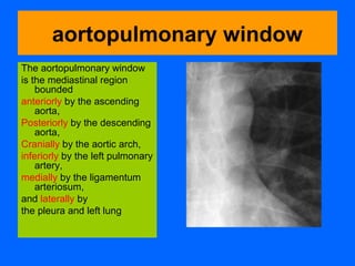Thoracic imaging terminology | PPT