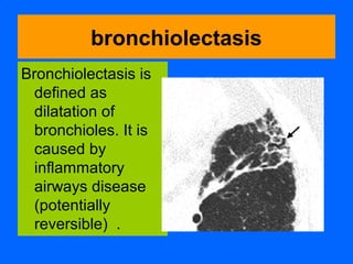 Thoracic imaging terminology | PPT