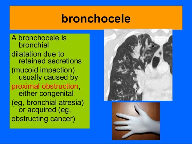 Thoracic imaging terminology