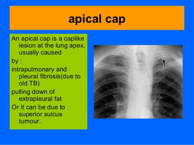 Thoracic imaging terminology