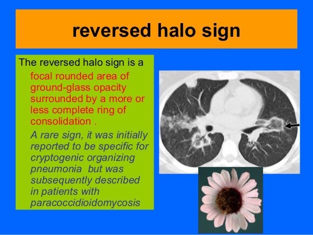 Thoracic imaging terminology
