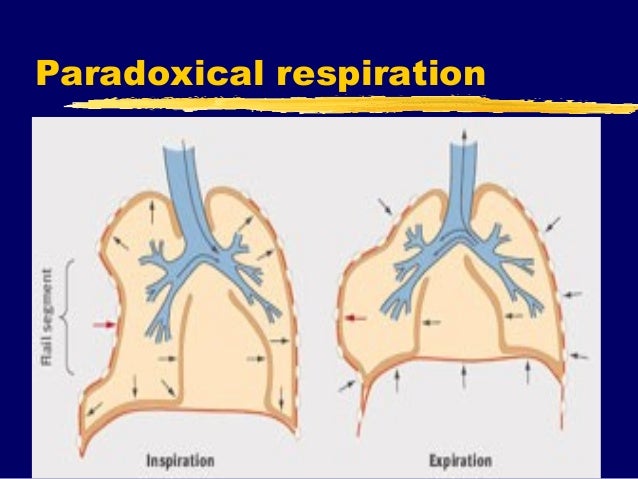 Thoracic trauma