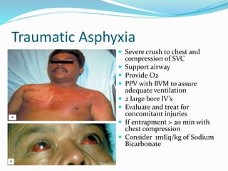 Thoracic trauma | PPT
