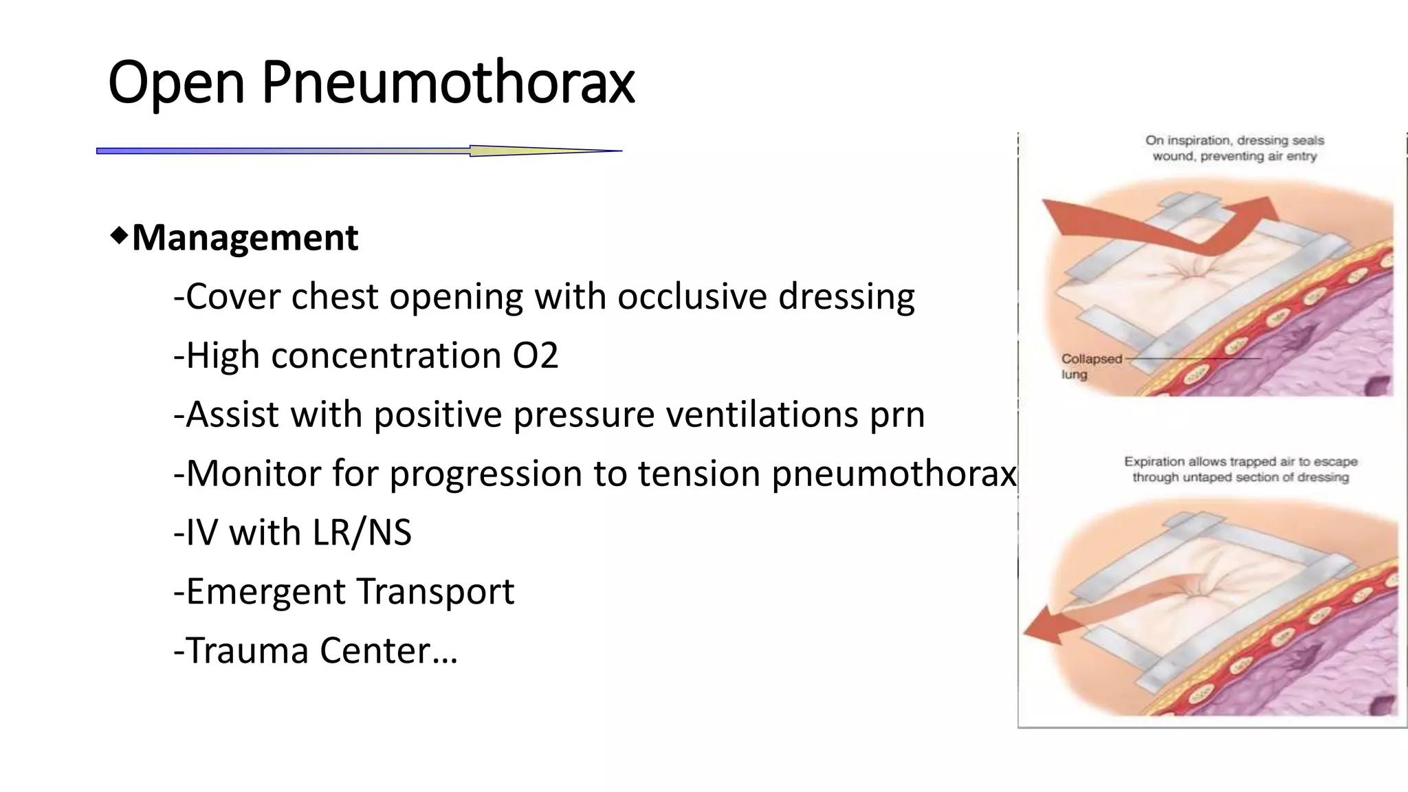 Thoracic trauma | PPTX