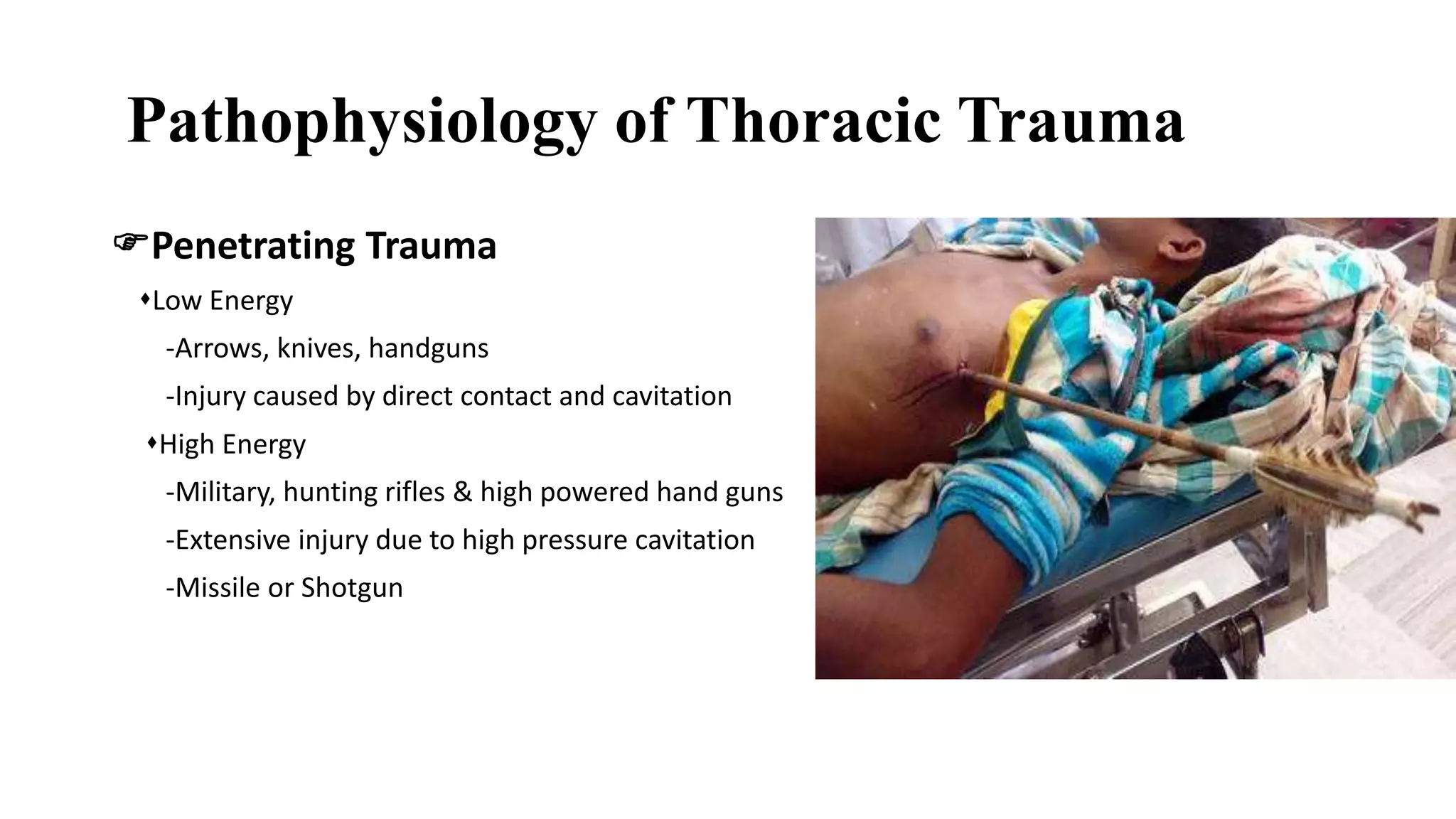 Thoracic trauma | PPTX