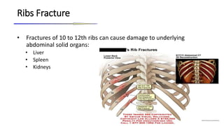 Thoracic trauma | PPTX