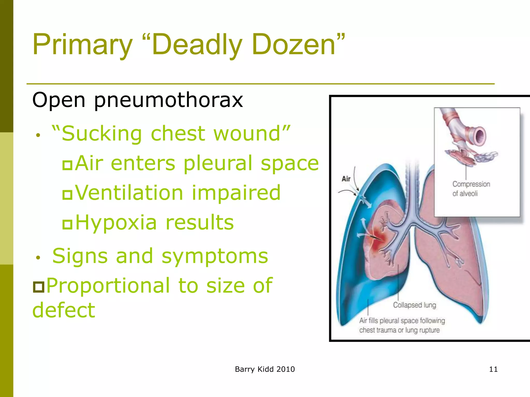 Thoracic trauma | PPT