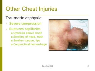 Thoracic trauma | PPT