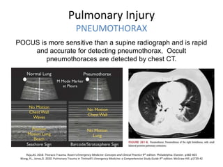 Thoracic Trauma.pptx
