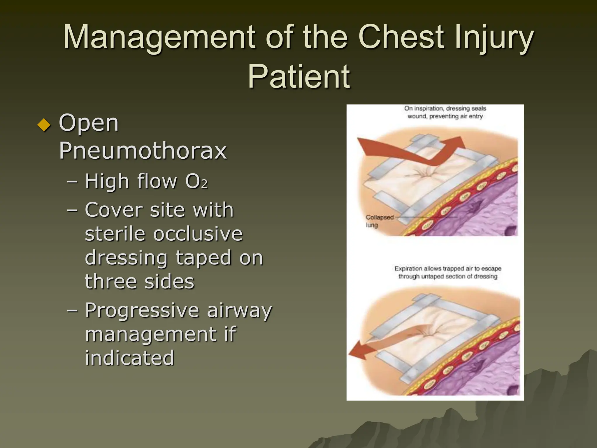 thoracic trauma all types of management.ppt