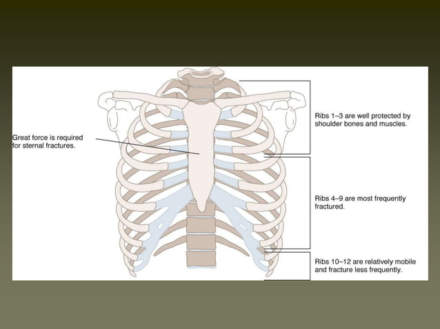 thoracic trauma all types of management.ppt
