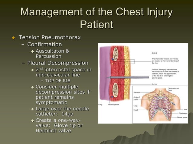thoracic trauma all types of management.ppt
