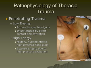 thoracic trauma all types of management.ppt