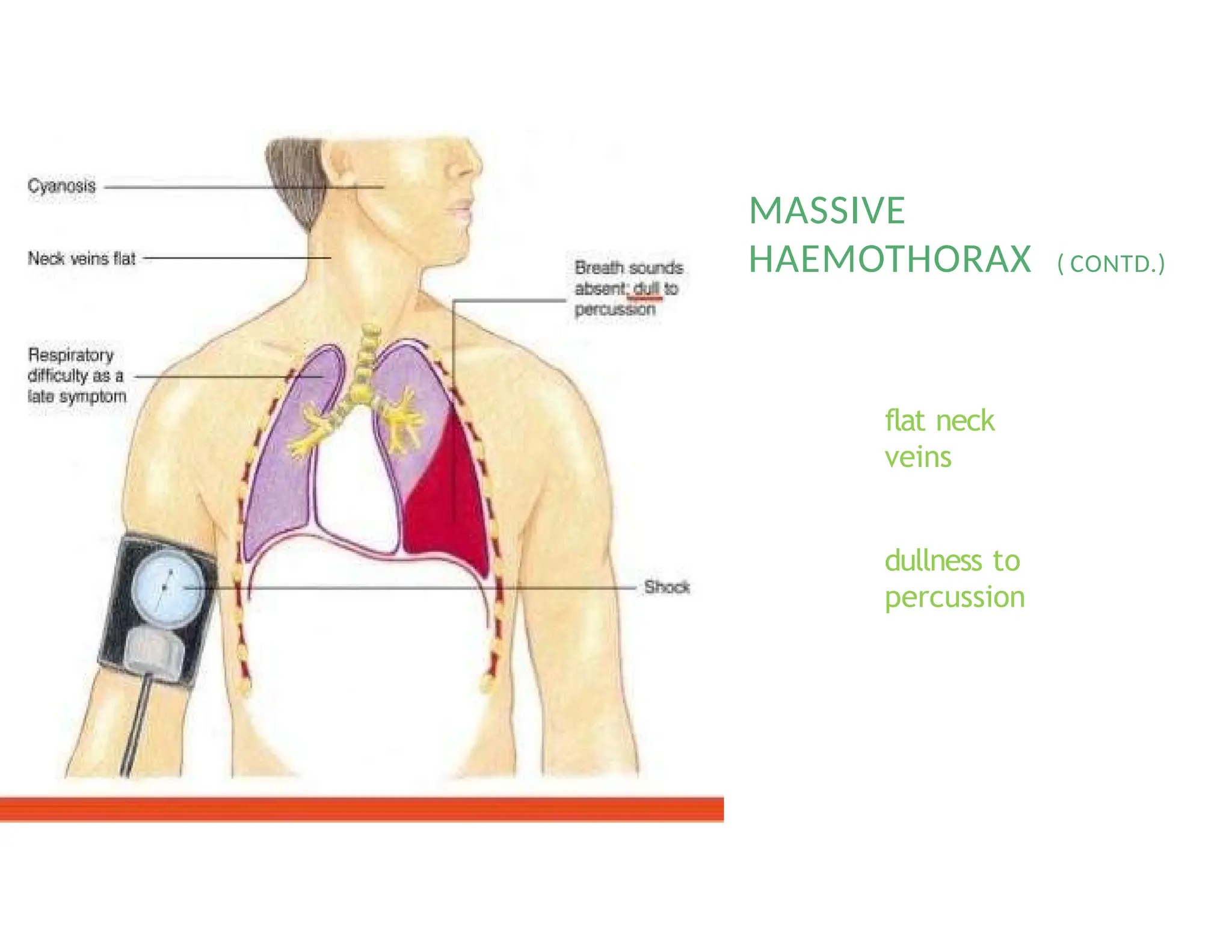 Thoracic and cardiovascular trauma surgery.pptx