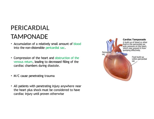 Thoracic and cardiovascular trauma surgery.pptx