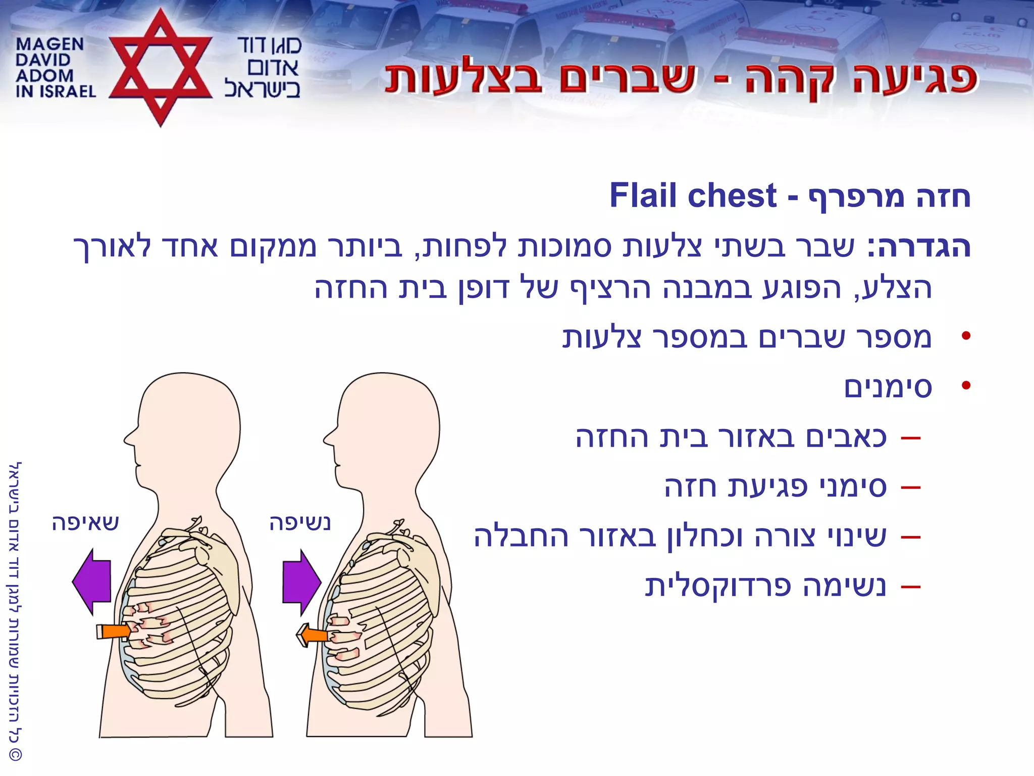 Thoracic trauma 60 | PPT