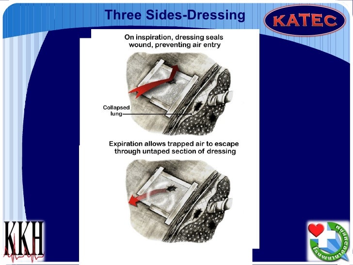 Thoracic trauma katec