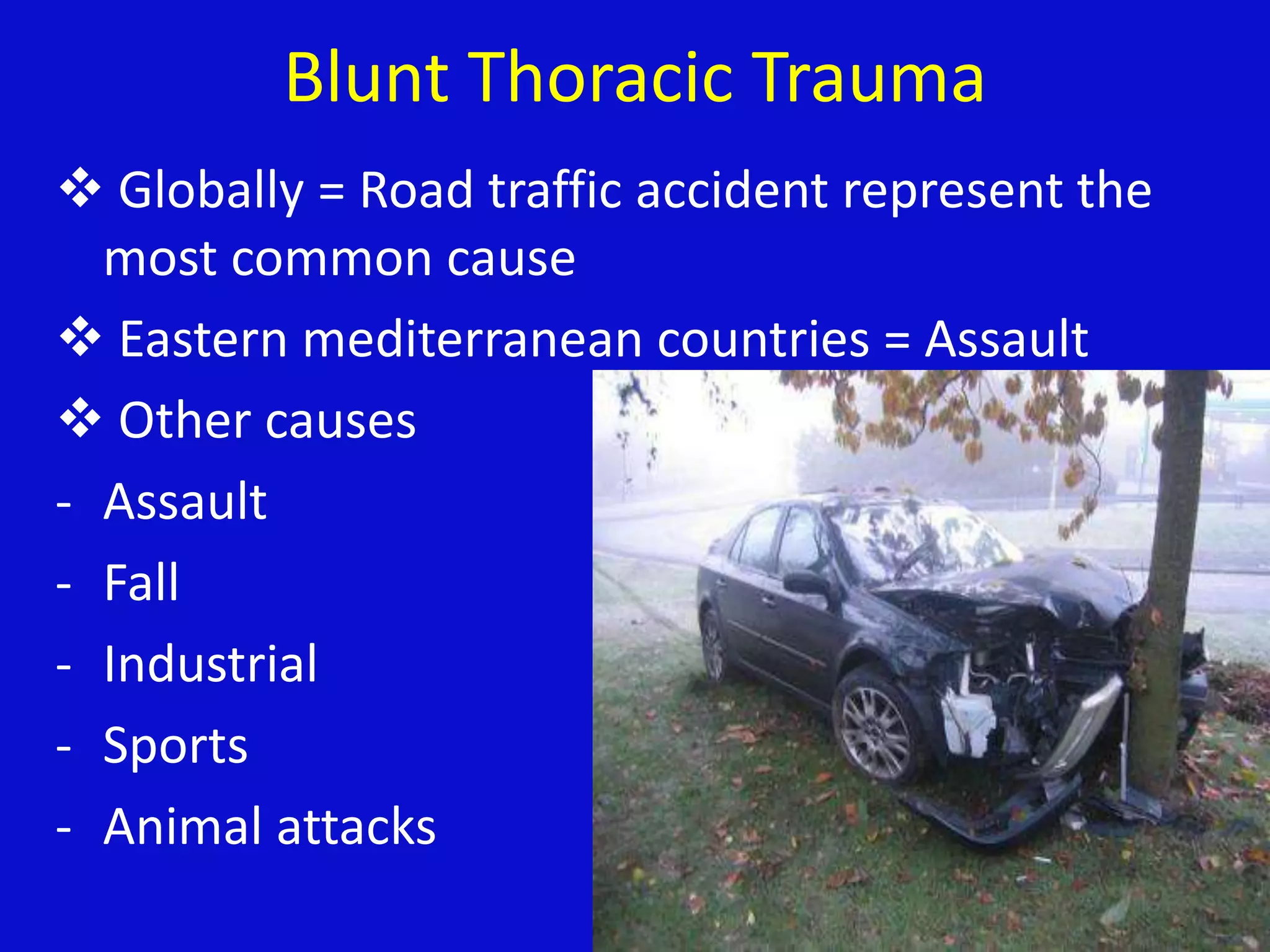 Thoracic trauma and pain management | PPTX
