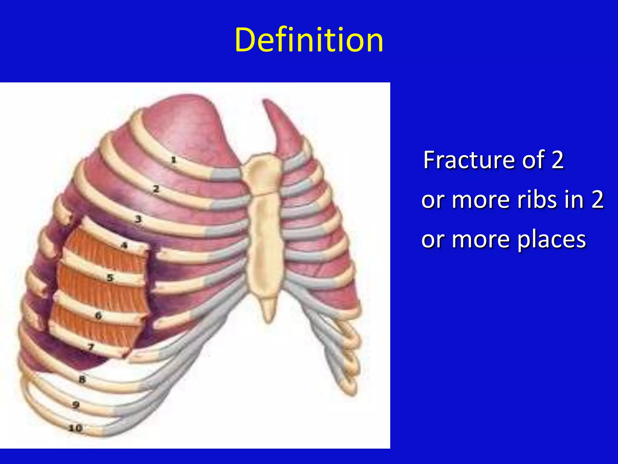 Thoracic trauma and pain management | PPTX