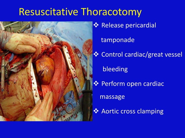 Thoracic trauma and pain management | PPT
