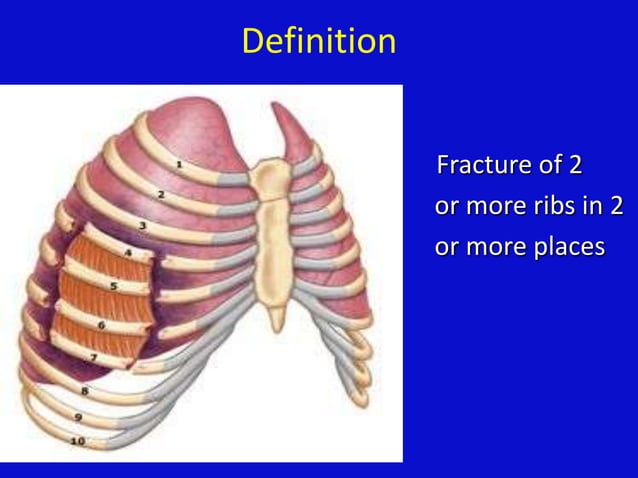 Thoracic trauma and pain management | PPT
