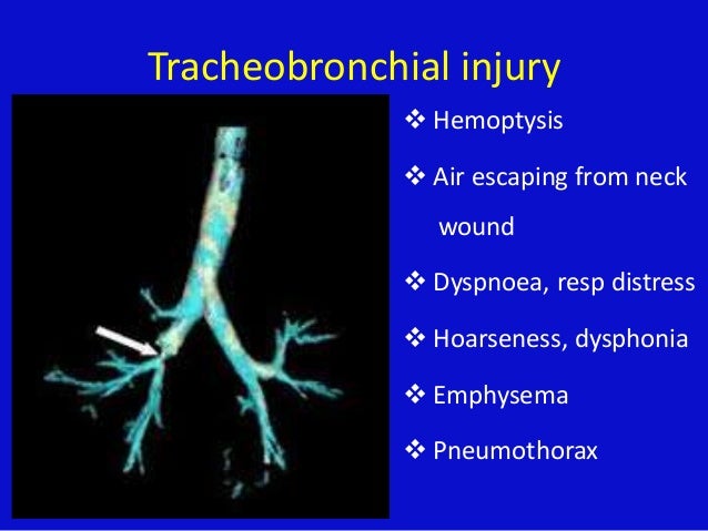 Thoracic trauma and pain management