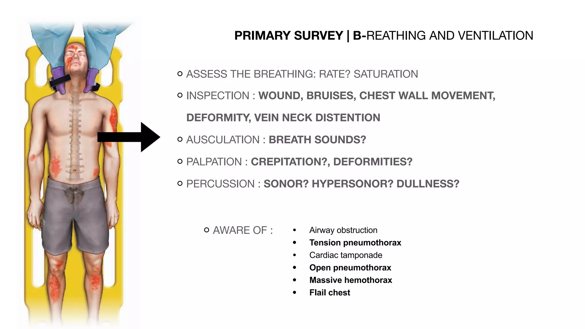 Thoracic Trauma - Navy Laksmono.pdf
