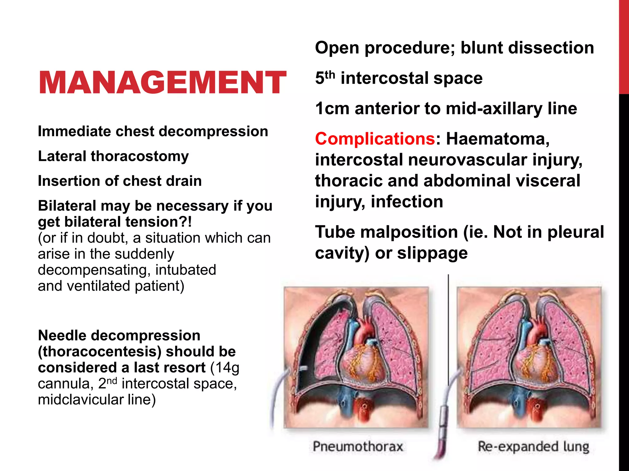 Thoracic trauma presentation | PPTX