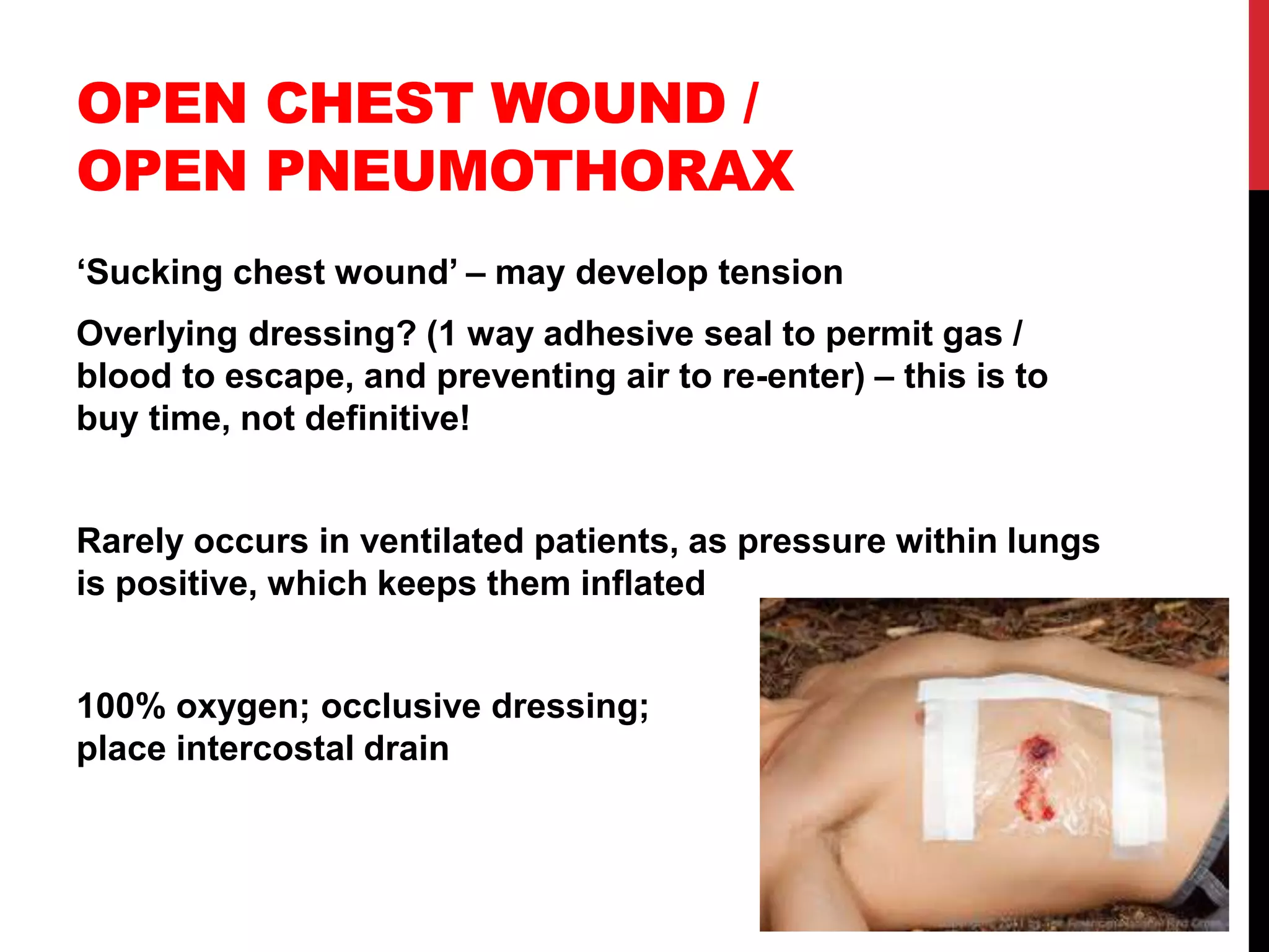 Thoracic trauma presentation | PPTX